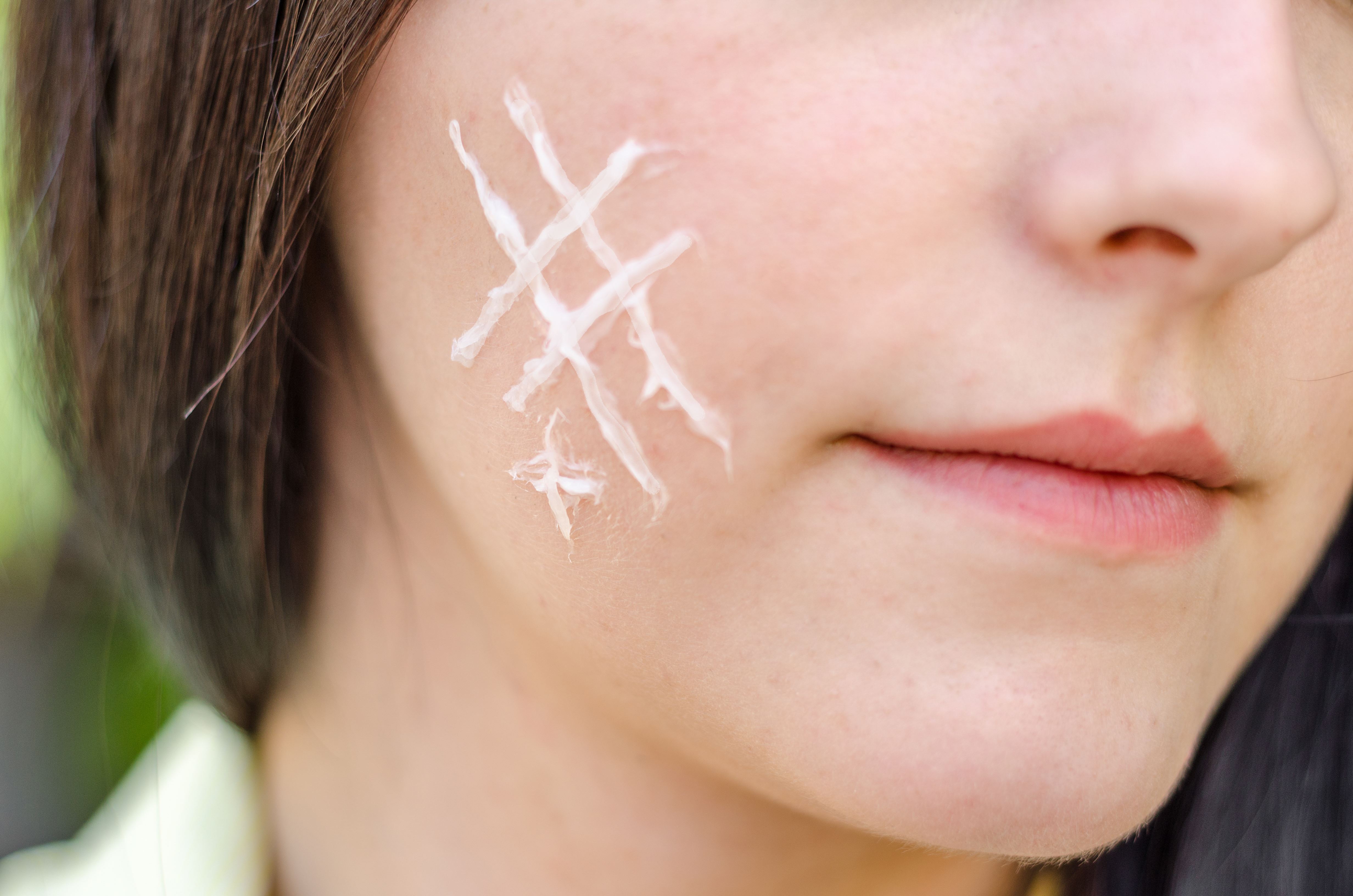 Narbenpflege - effektiv pflegen und behandeln. | wellvida ag